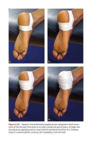 Shin Splints Taping Techniques Human Kinetics Blog Shin Splints Taping Techniques Human Kinetics Blog